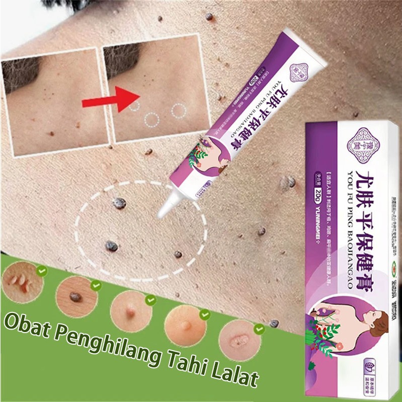 Jual Obat penghilang tahi lalat penghilang kutil dan tahi lalat obat ...