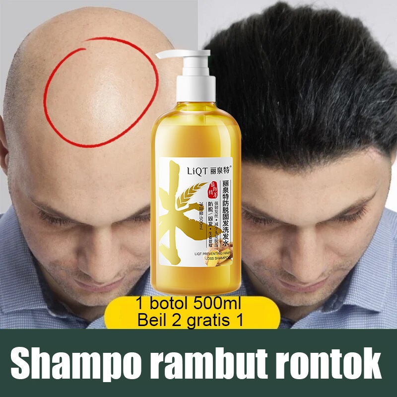 Jual Shampo rambut rontok Shampo penumbuh rambut cepat shampo anti ...