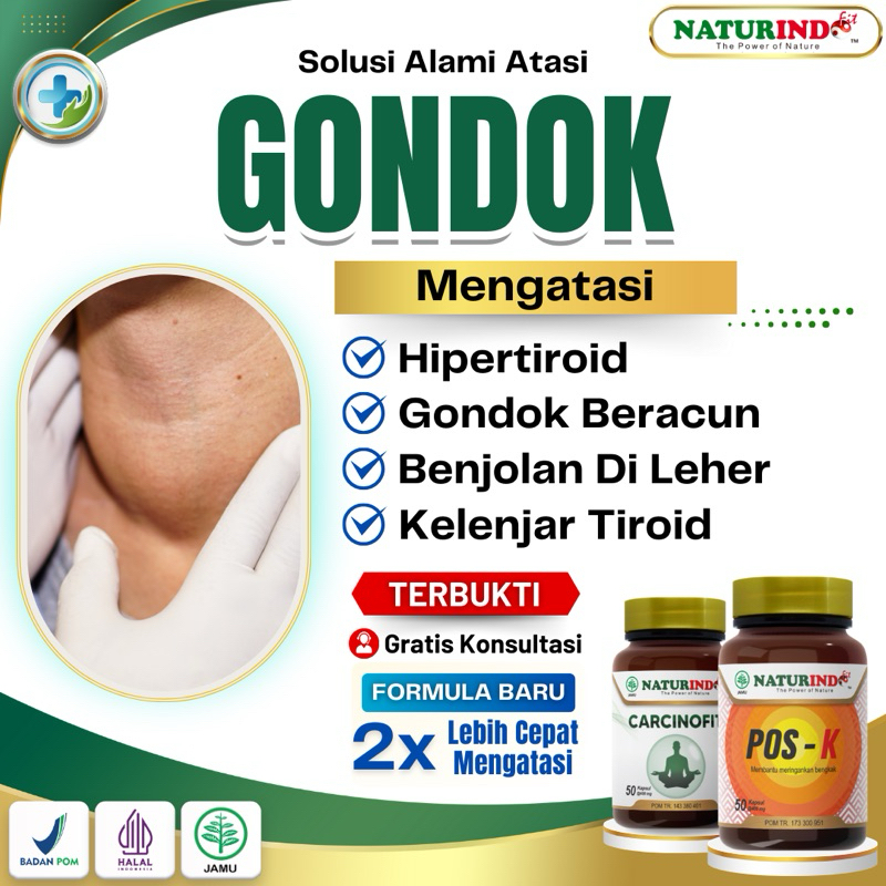 Jual Obat Gondok Benjolan Di Leher Ampuh Tiroid Hipertiroid Gondok ...