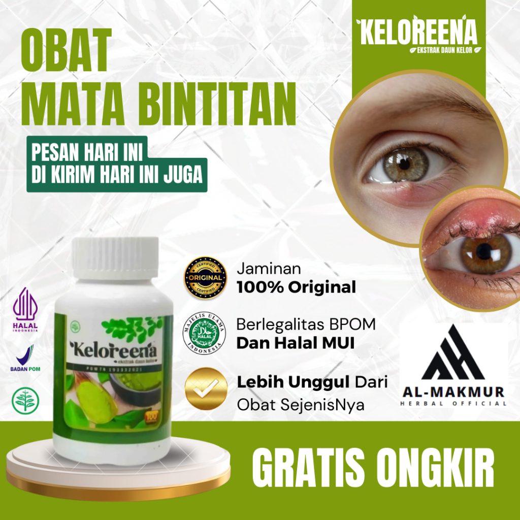 Jual Obat Penyakit Kalazion Pada Mata, Obat Penghilang Mata Bintitan ...
