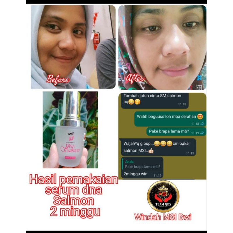 Jual Serum DNA Salmon | Shopee Indonesia