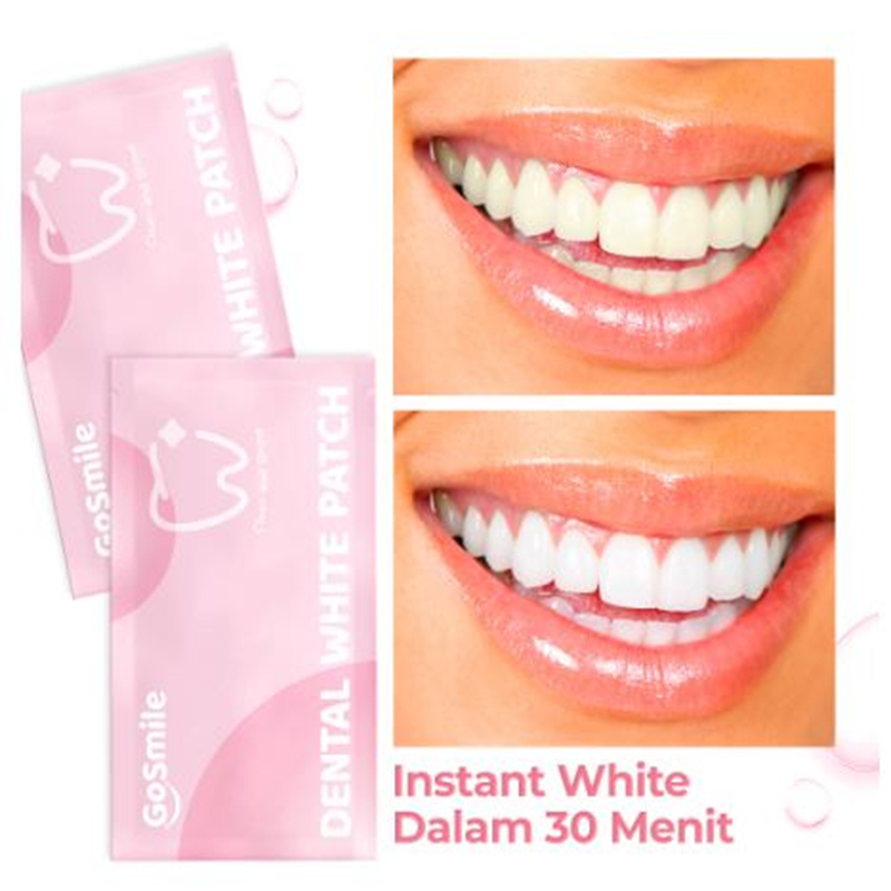 Jual Go Smile Dental White Patch - Memutihkan Gigi - Bleaching dengan ...