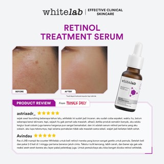 Jual Whitelab Retinol Treatment Serum - Serum Anti Aging Kaya ...