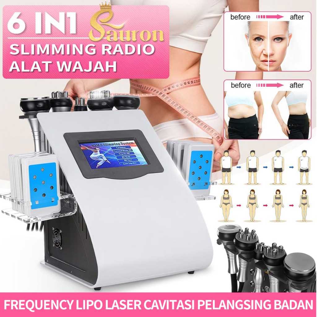 Jual ⚡GARANSI 1 TAHUN⚡ Sauron 40K RF 6 in 1 Slimming radio Alat wajah ...