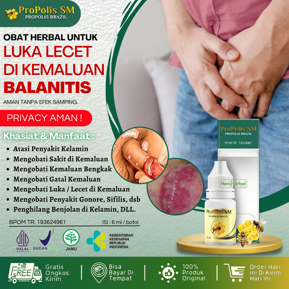 Jual Obat Balanitis Oles Herbal Alami, Obat Balanitis Pria, Pengering Lecet di Kepala Penis ...