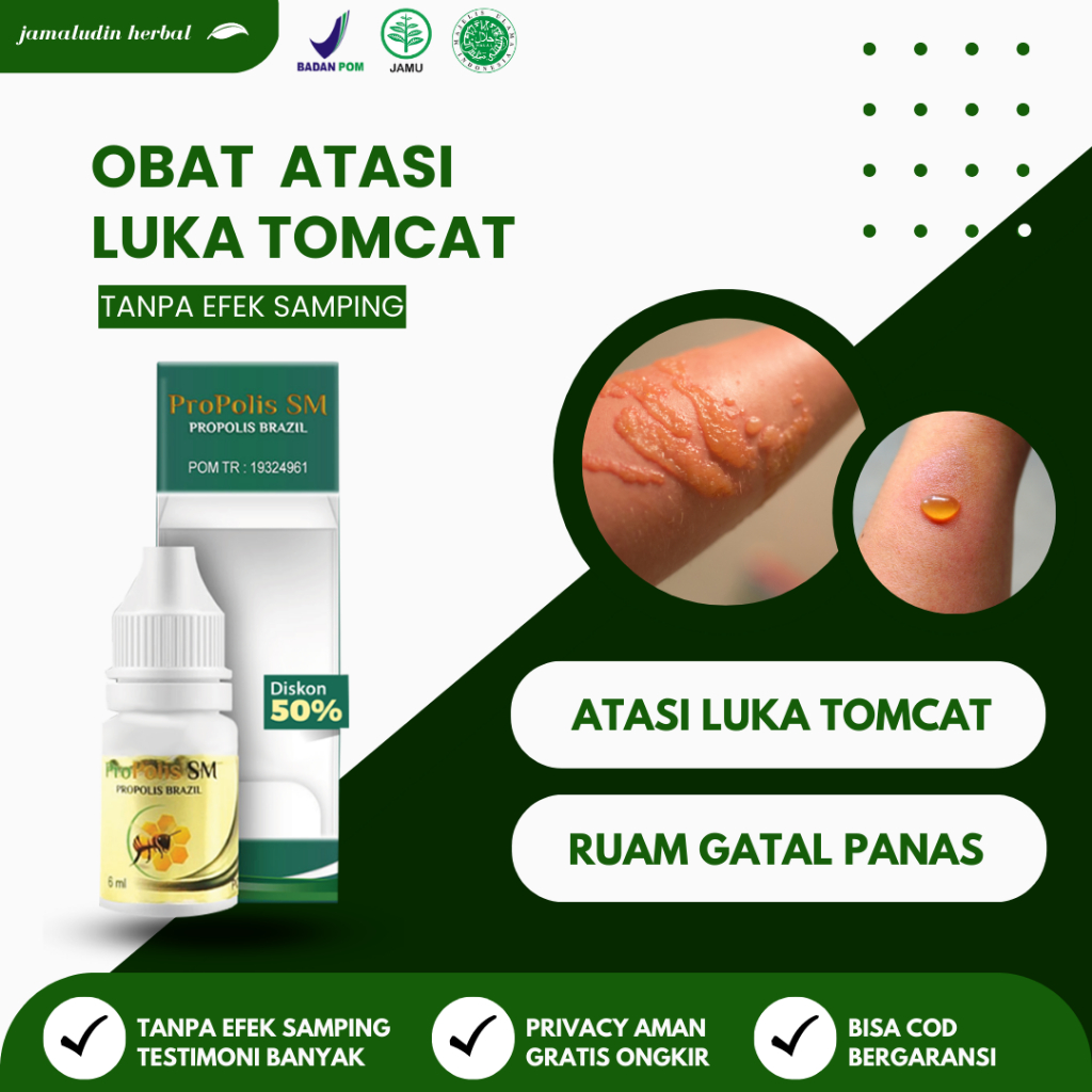 Jual Obat Tomcat Alami, Obat Tomcat Salep, Obat Tomcat Untuk Anak dan ...