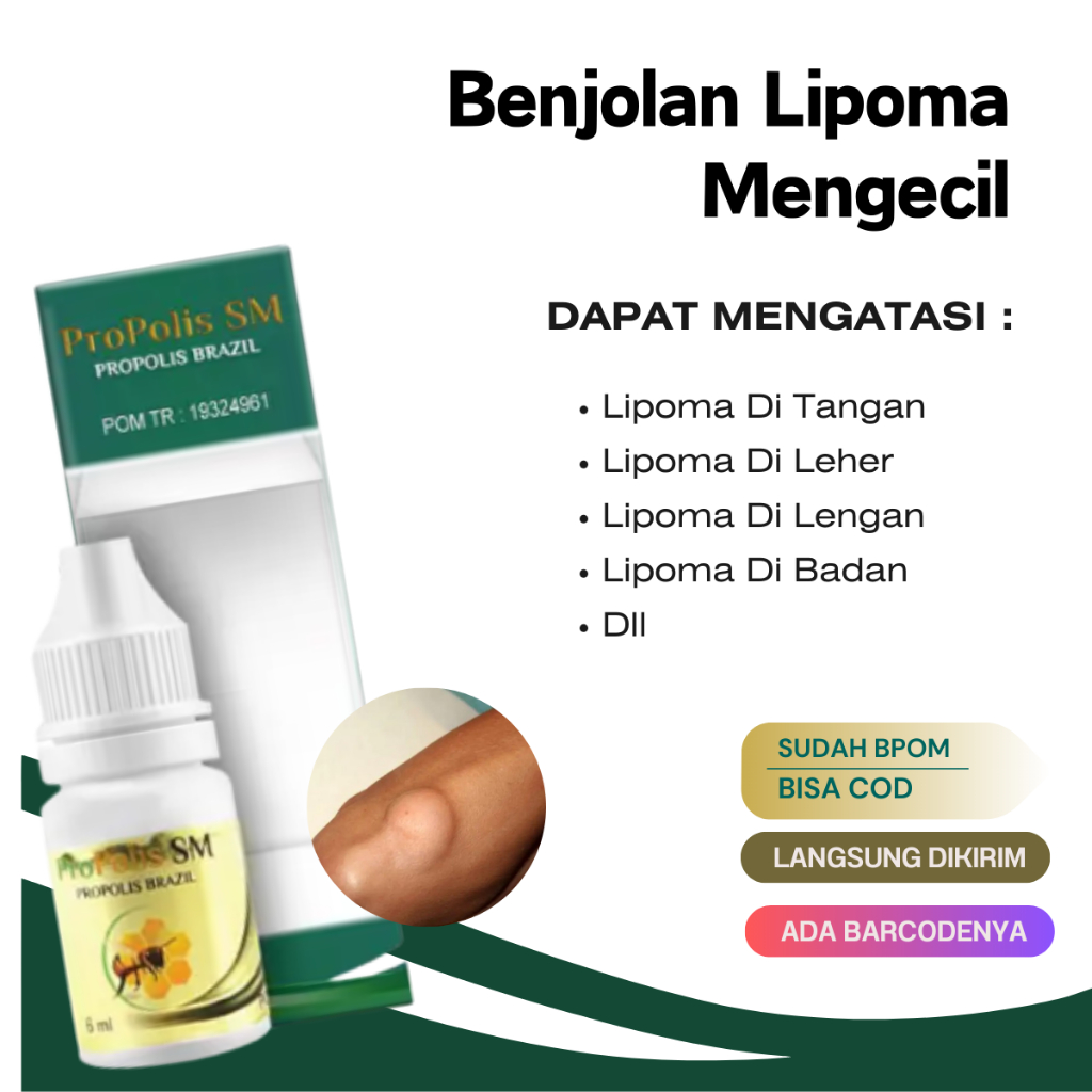 Jual Obat Lipoma Benjolan Keras Dan Tak Nyeri Propolis SM Brazilian 100 ...