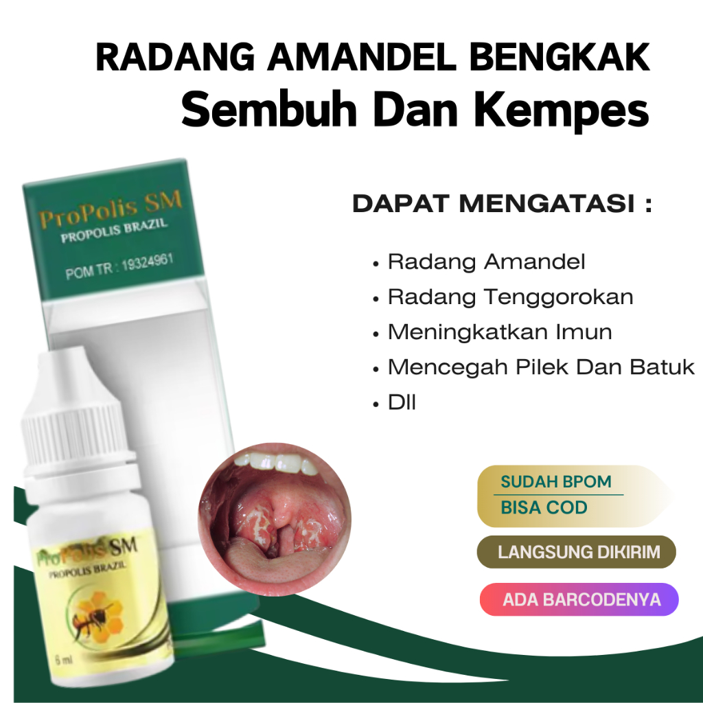 Jual Obat Radang Amandel Anak Dan Dewasa Propolis SM Brazilian 100% Asli - Kempeskan Benjolan ...