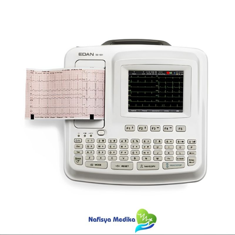 Jual ECG 6 CHANNEL / ECG EDAN SE-601 PORTABLE / EKG ELECTROCARDIOGRAPH | Shopee Indonesia