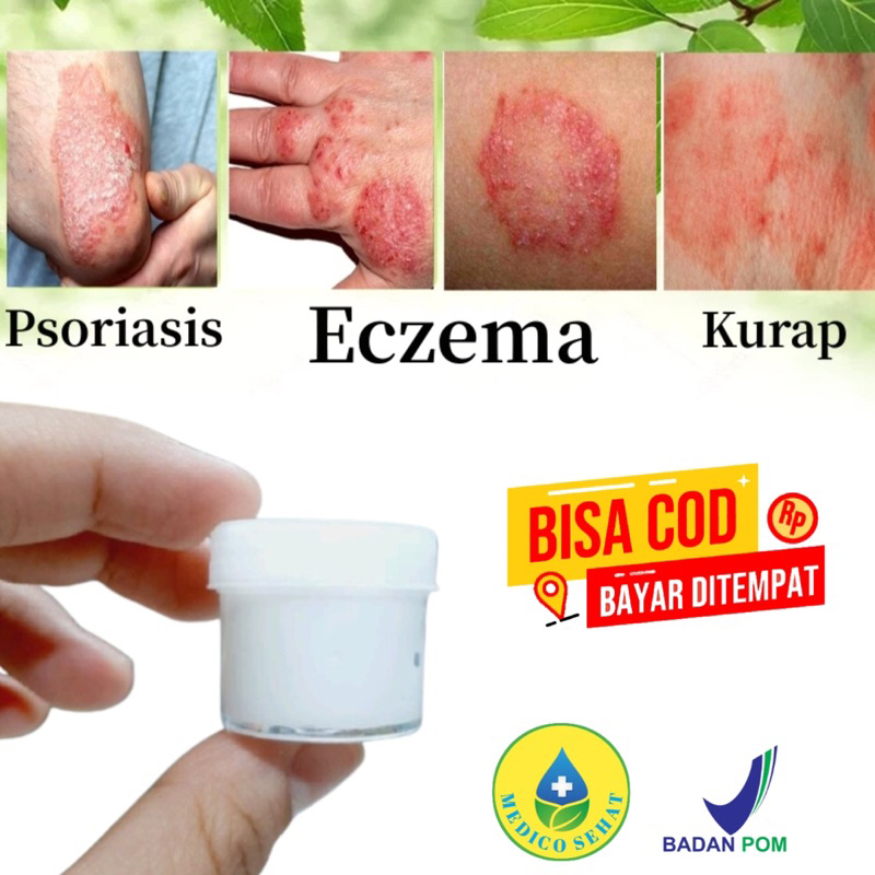 Jual Salep Gatal Racikan Spesialis kulit serbaguna salep khusus untuk ...