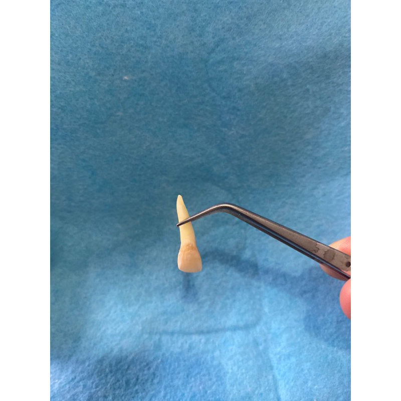 Jual Gigi insisivus lateral RA (gigi 12) | Shopee Indonesia