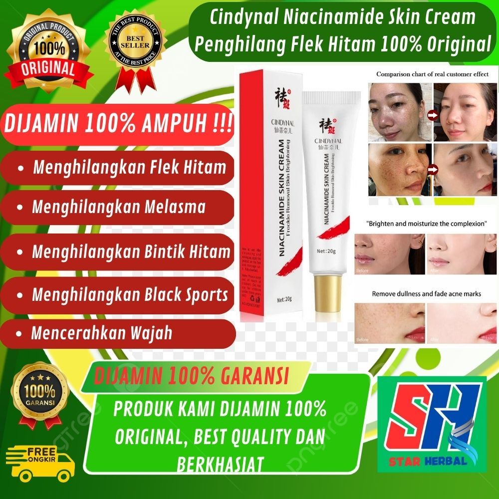Jual Cindynal Cream Crem Krim Penghilang Flek Hitam / Menghilangkan Bintik Hitam / Menghilangkan ...