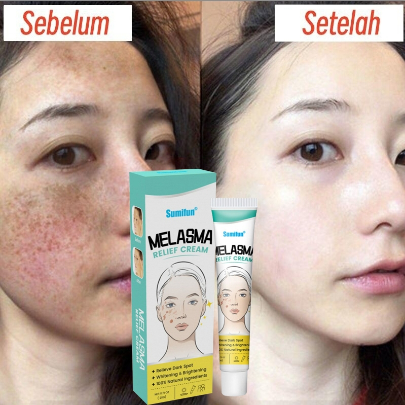 Jual Cream flek hitam membandel Dark Spot Corrector Cream krim ...