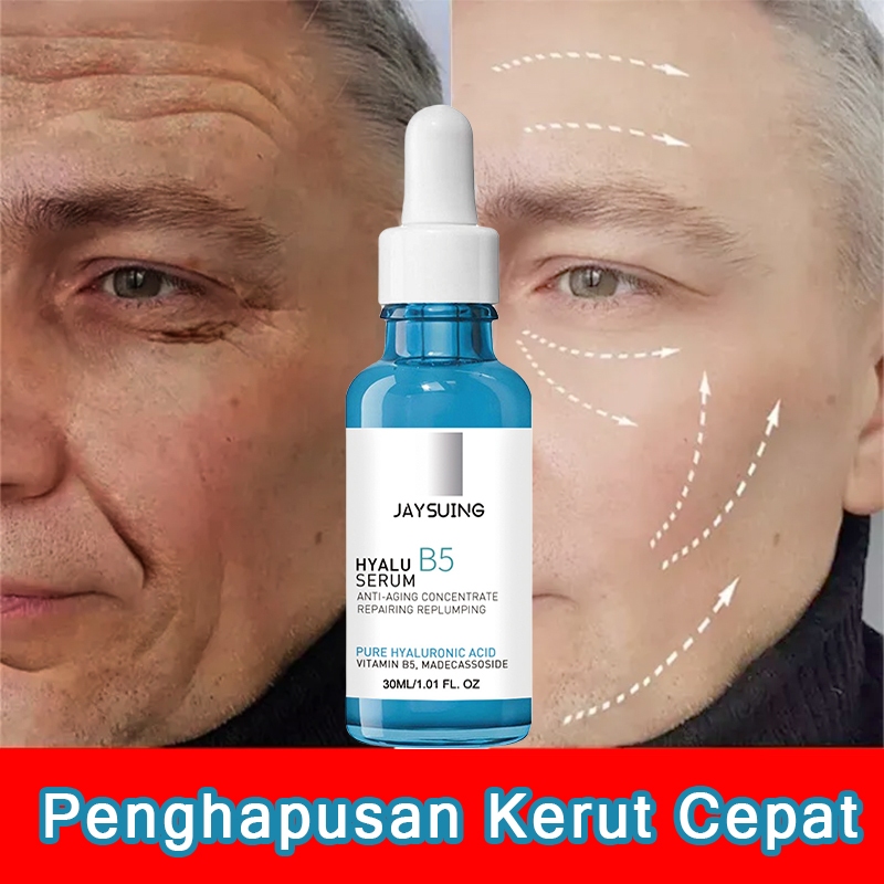 Jual whitening serum Penghilang kerutan wajah serum anti aging dan ...