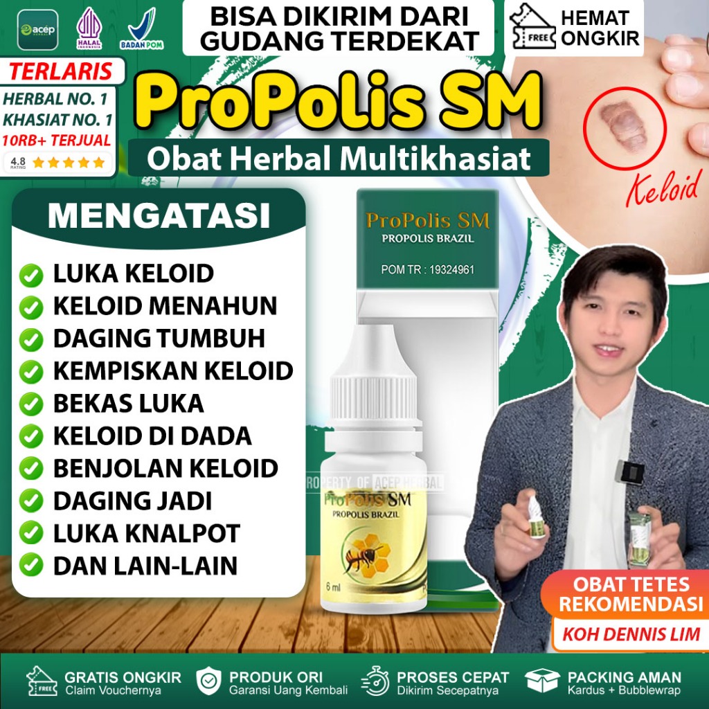 Jual Obat Keloid Daging Tumbuh Daging Jadi Penghilang Keloid Luka Tindik Di Telinga Bekas ...