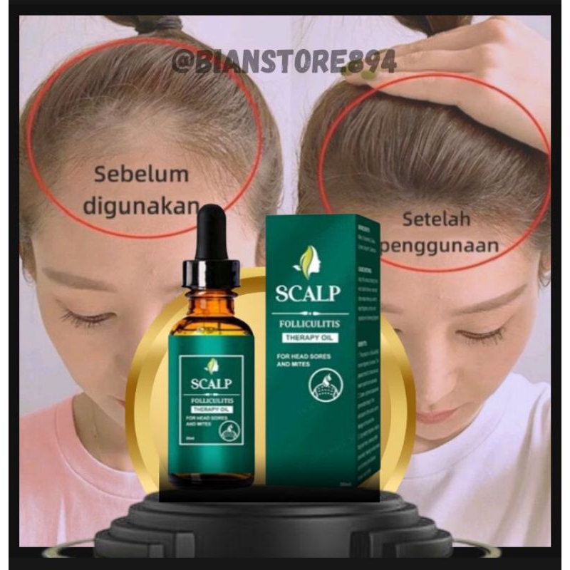 Jual OBAT PENUMBUH RAMBUT BOTAK SERUM PENUMBUH RAMBUT SCALP HAIR CARE ...
