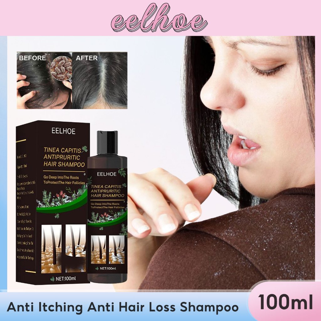 Jual EELHOE Tinea Capitis Antipruritic Hair Shampoo - Cocok untuk ...