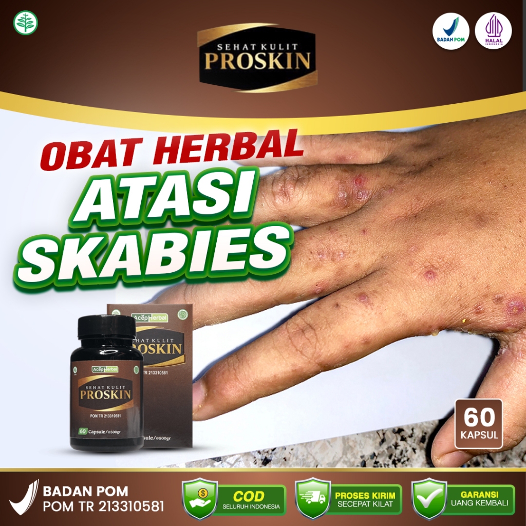 Jual Proskin Vitamin Herbal 100% Asli BPOM Halal MUI Atasi Penyakit ... Jual Proskin Vitamin Herbal 100% Asli BPOM Halal MUI Atasi Penyakit ...