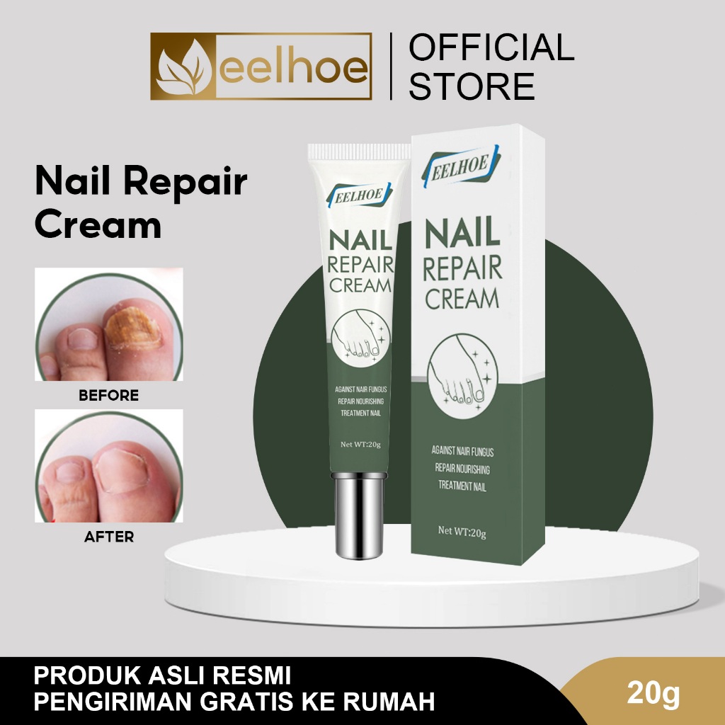 Jual Eelhoe Nail Repair Cream 20g - Krim Menghilangkan Jamur Kuku ...