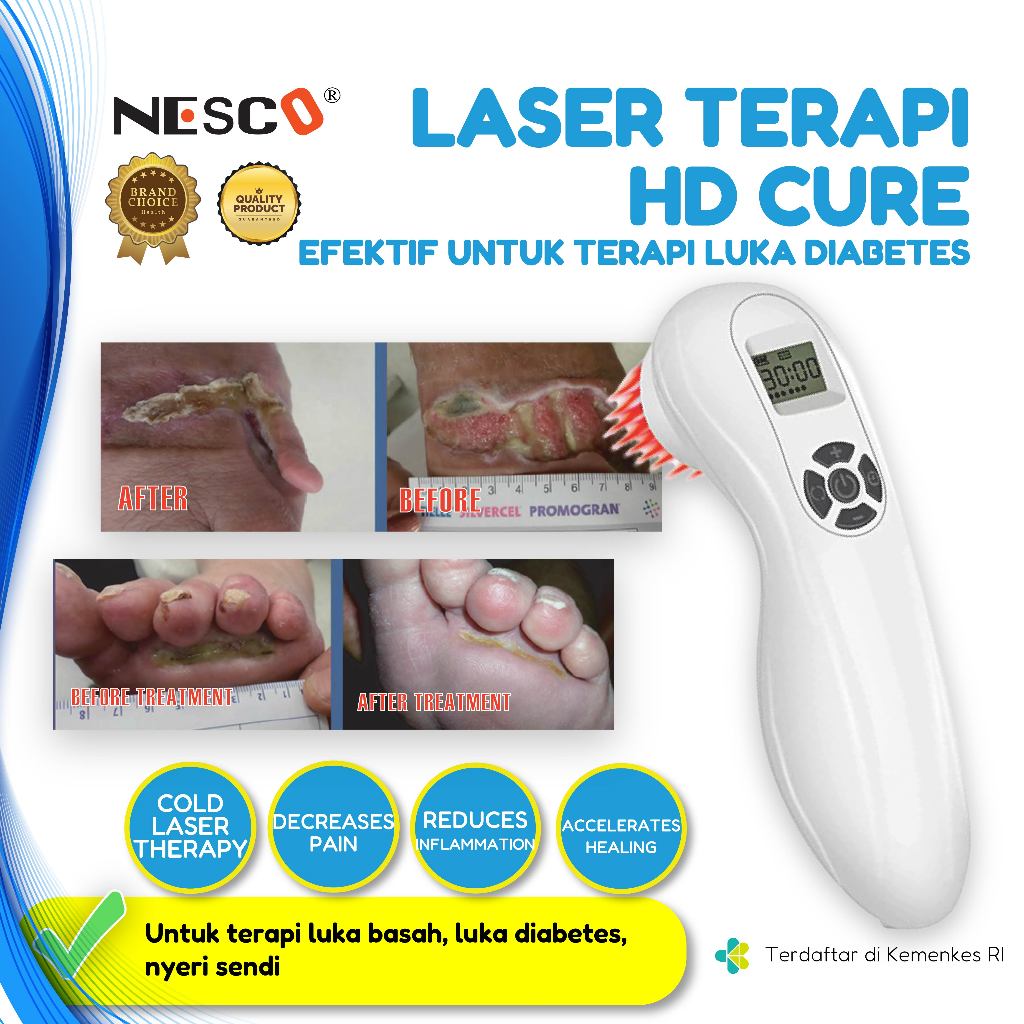 Jual Laser Therapi : HD CURE UNTUK TERAPI LUKA BASAH, LUKA DIABETES ...