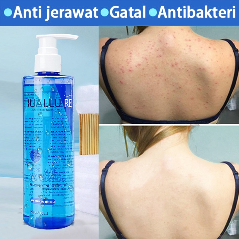 Jual Sabun gatal kulit ampuh Eczema body wash Obat gatal kulit paling ... Jual Sabun gatal kulit ampuh Eczema body wash Obat gatal kulit paling ...
