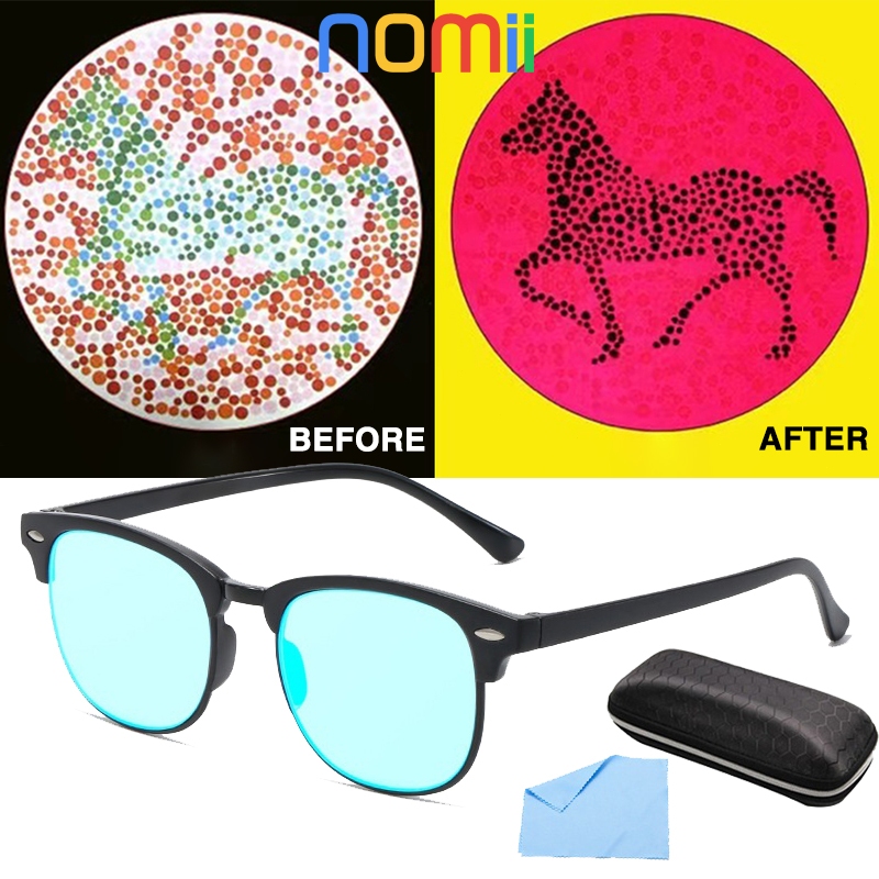 Jual Anti Bluelight/Kacamata Buta Warna Parsial Merah Hijau Atau ...