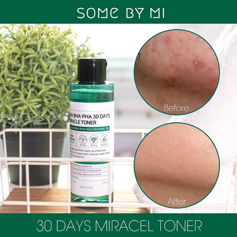 Jual SOMEBYMI-AHA-BHA-PHA 30 Days Miracle Toner 100mL | Shopee Indonesia