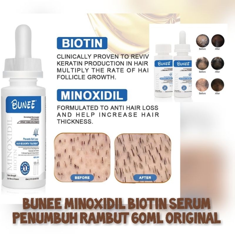 Jual bunee minoxidil biotin serum penumbuh rambut 60ml original ...