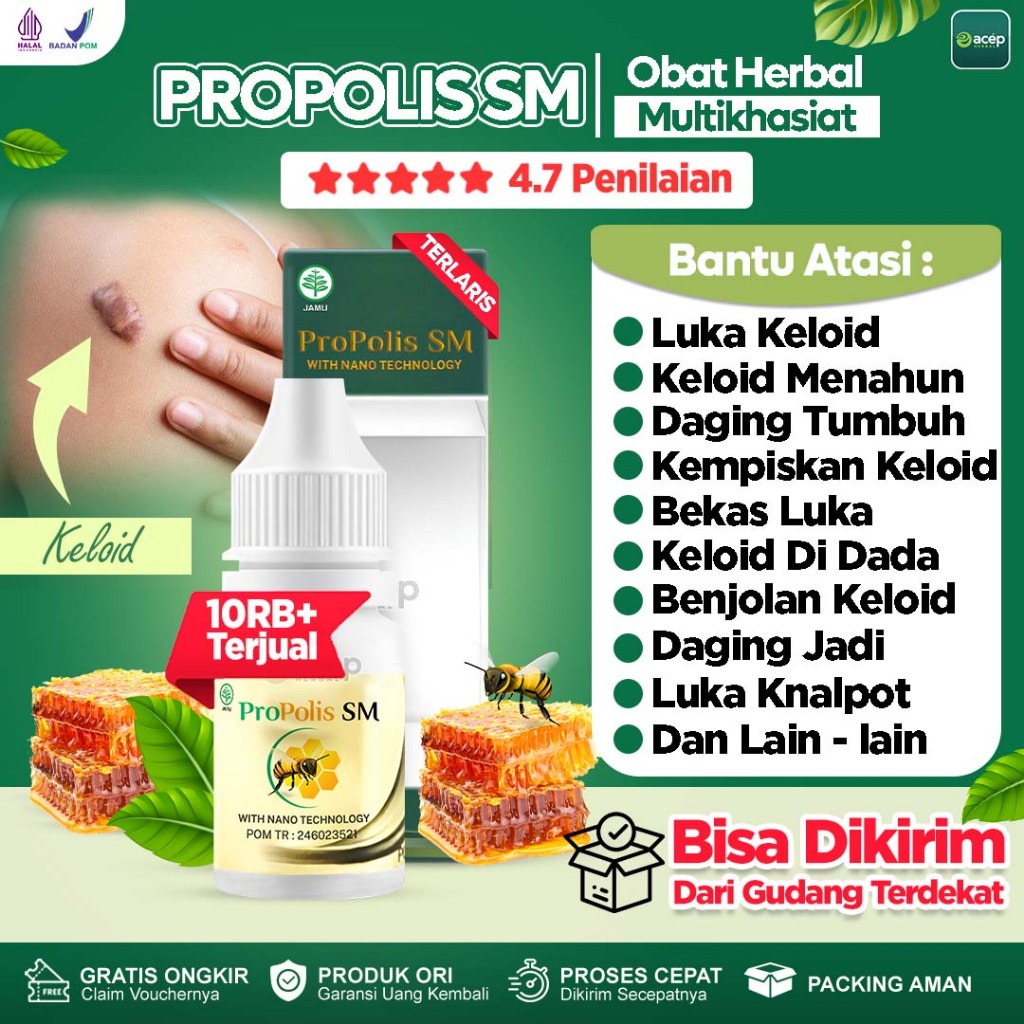 Jual Obat Keloid Daging Tumbuh Daging Jadi Penghilang Keloid Luka Tindik Di Telinga Bekas ...