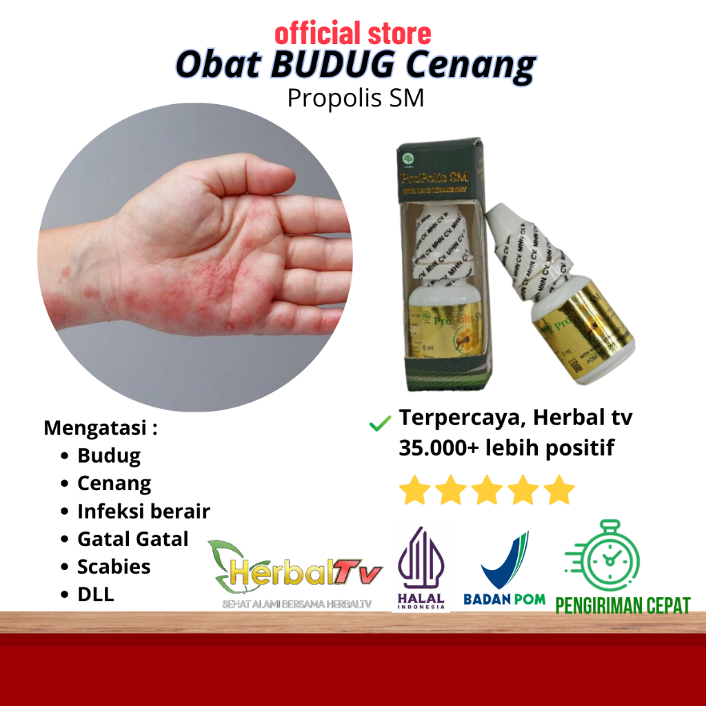 Jual Obat Gatal Bernanah Budug Cenang Koreng pada Kulit Scabies Pada ...