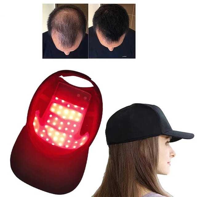 Jual Topi Terapi Rambut Kepala Infrared Lampu LED Merah Untuk Prawatan ...