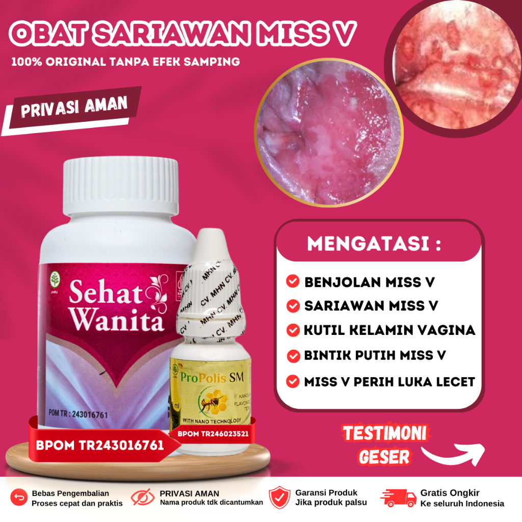 Jual Obat Sariawan Miss v, Obat miss v perih da gatal Vagina , Infeksi ...