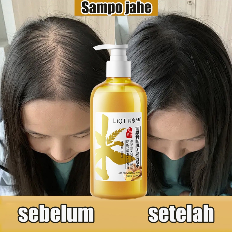 Jual [100% asli]shampoo anti rontok sampo rambut rontok shampo penumbuh rambut cepat 500ml Jahe ...