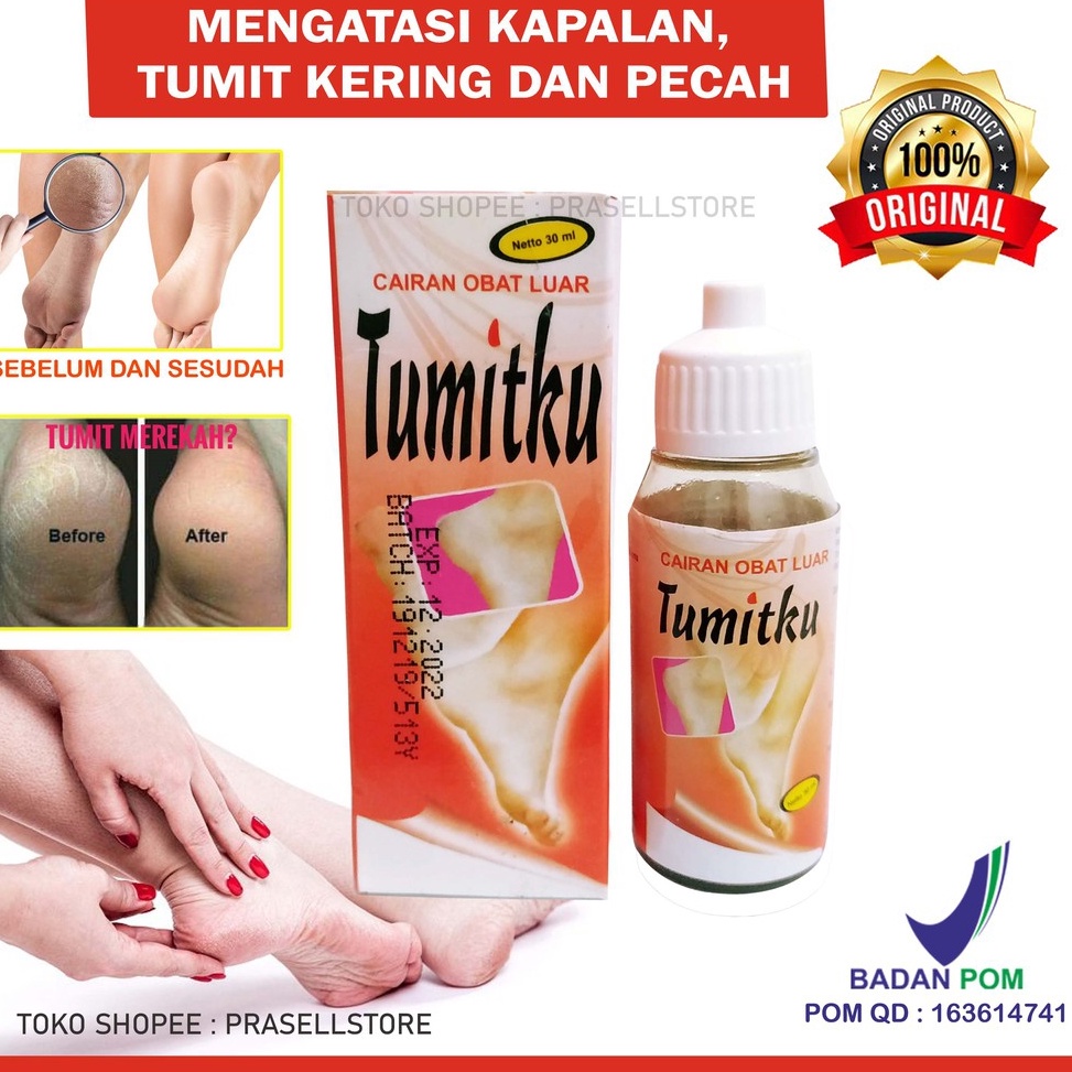 Jual KODE I38S Tumitku Obat Kapalan dan Kaki PecahPecah 3ml 1 Original ...