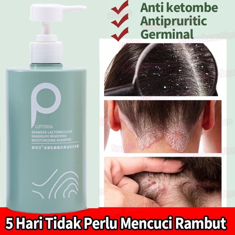 Jual shampo anti ketombe dan rontok sampo anti ketombe dan rontok shampoo anti ketombe shampoo ...
