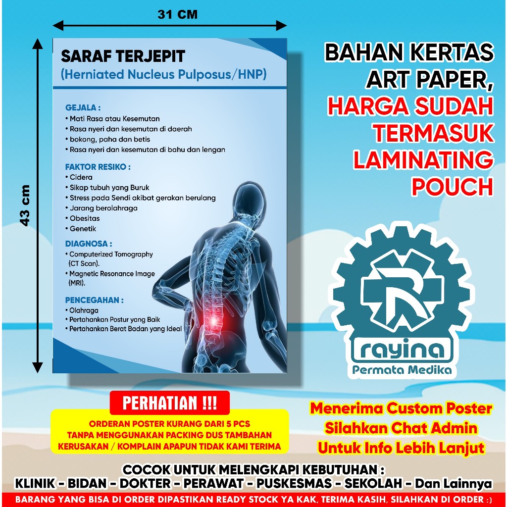 Jual Poster Kesehatan Saraf Terjepit | Shopee Indonesia