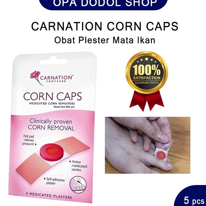Jual Carnation Corn Caps Plester Obat Mata Ikan e J4X4 | Shopee Indonesia