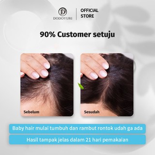 Jual [BPOM] DODOYURI Hair tonic rambut rontok Serum penumbuh rambut ...