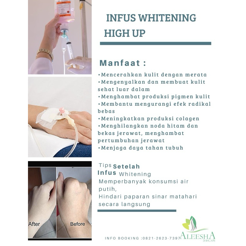 Jual INFUS WHITENING HIGH UP | Shopee Indonesia