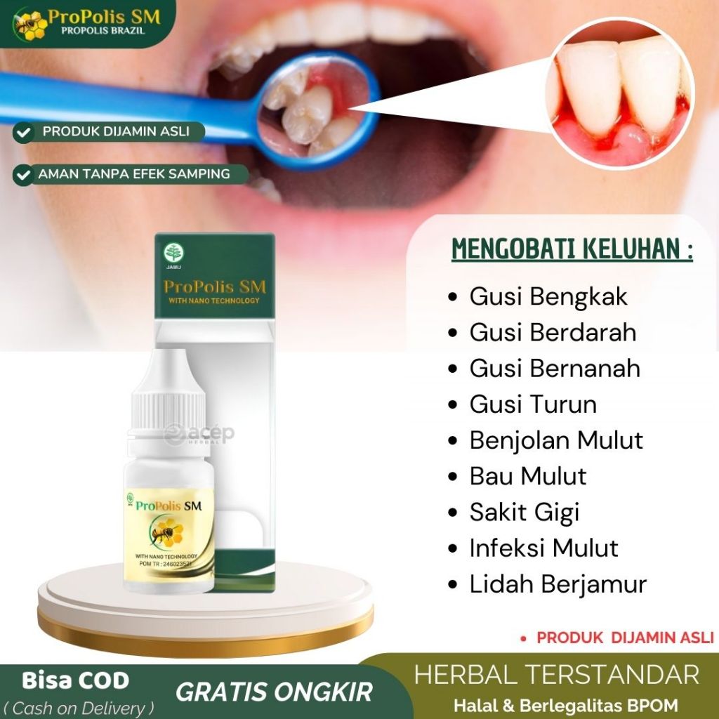 Jual Propolis sm Obat Radang Gusi Bengkak Gusi Berdarah Bernanah Gusi ...