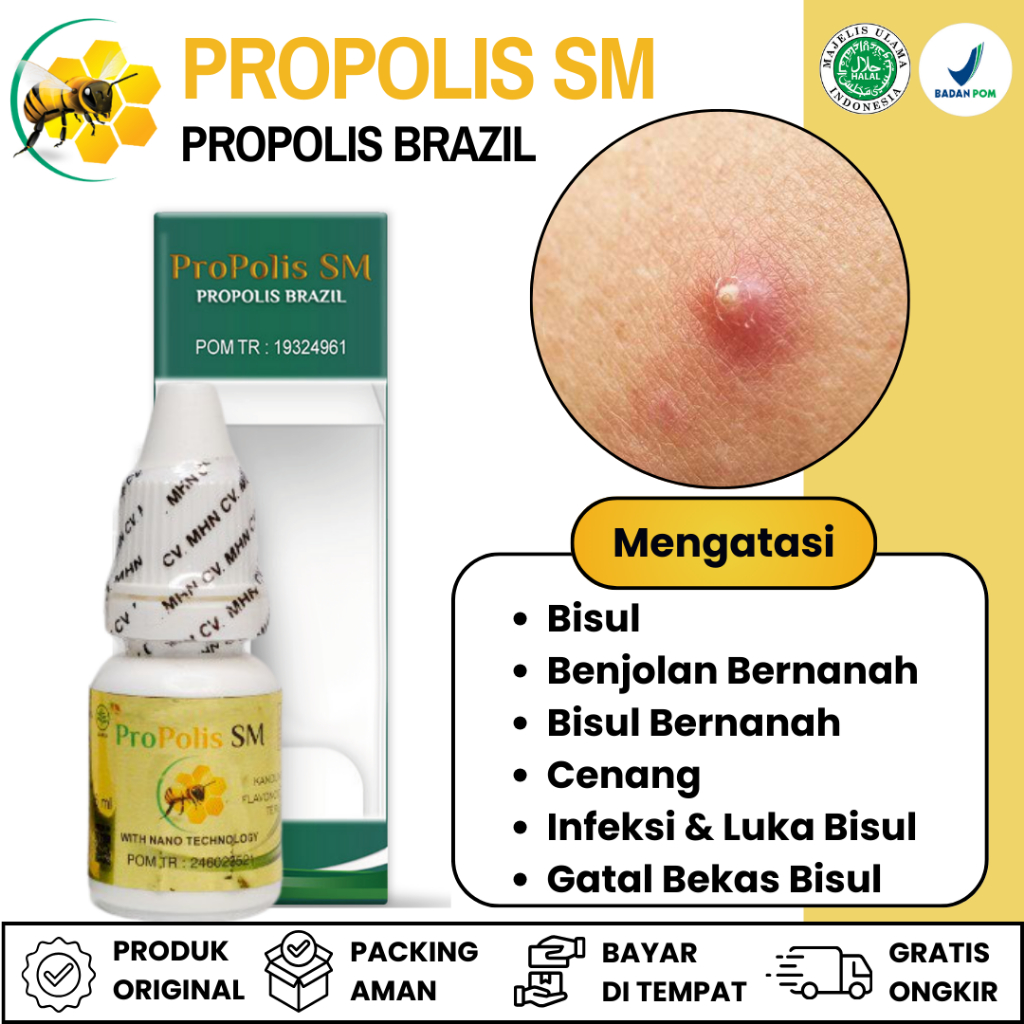 Jual Obat Benjolan Bernanah Bisul Cenang Bisul Bernanah Bisul Gatal ...