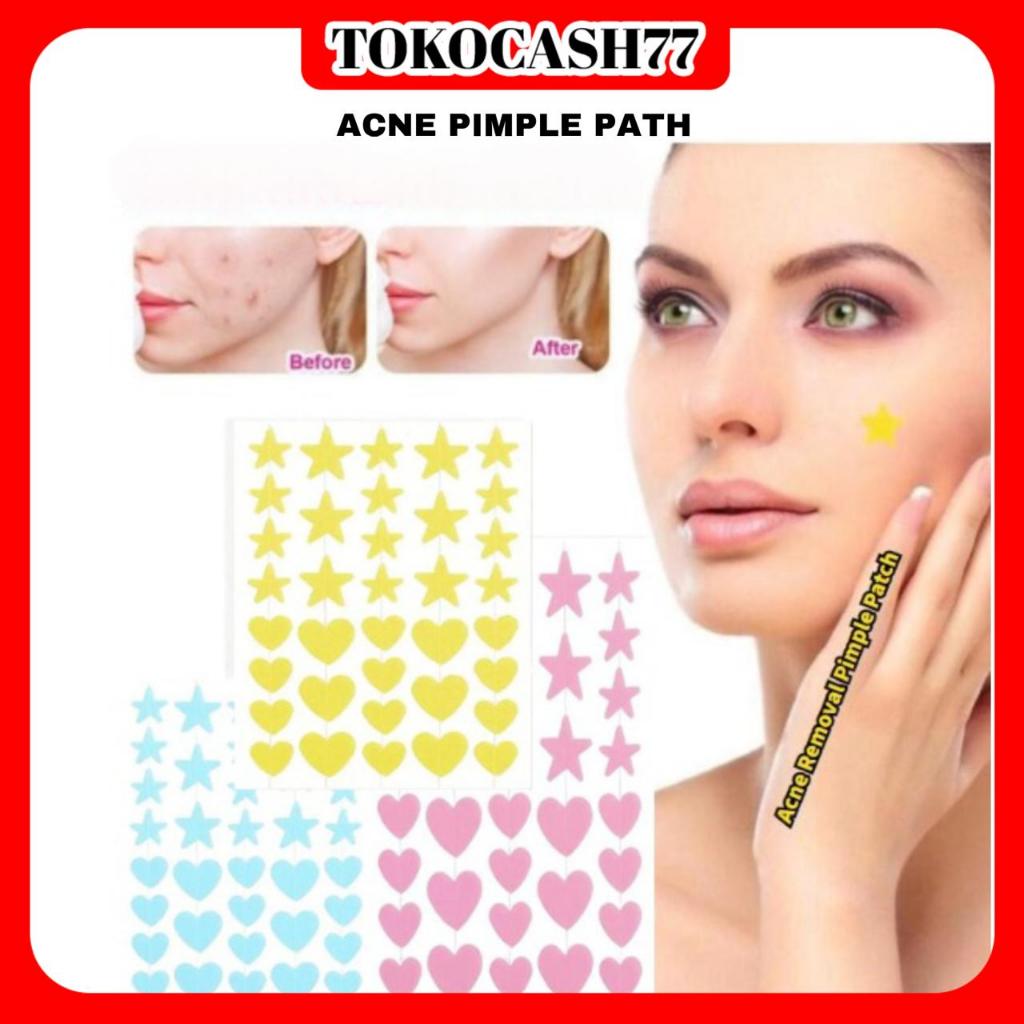 Jual ACNE PATCH STIKER PENGHILANG JERAWAT MOTIF LUCU / ACNE PIMPLE ...