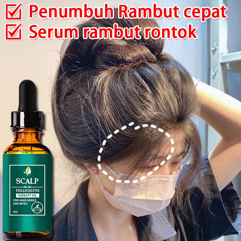 Jual Minyak Esensial Perawatan Rambut Rontok Rambut Rusak Serum ...