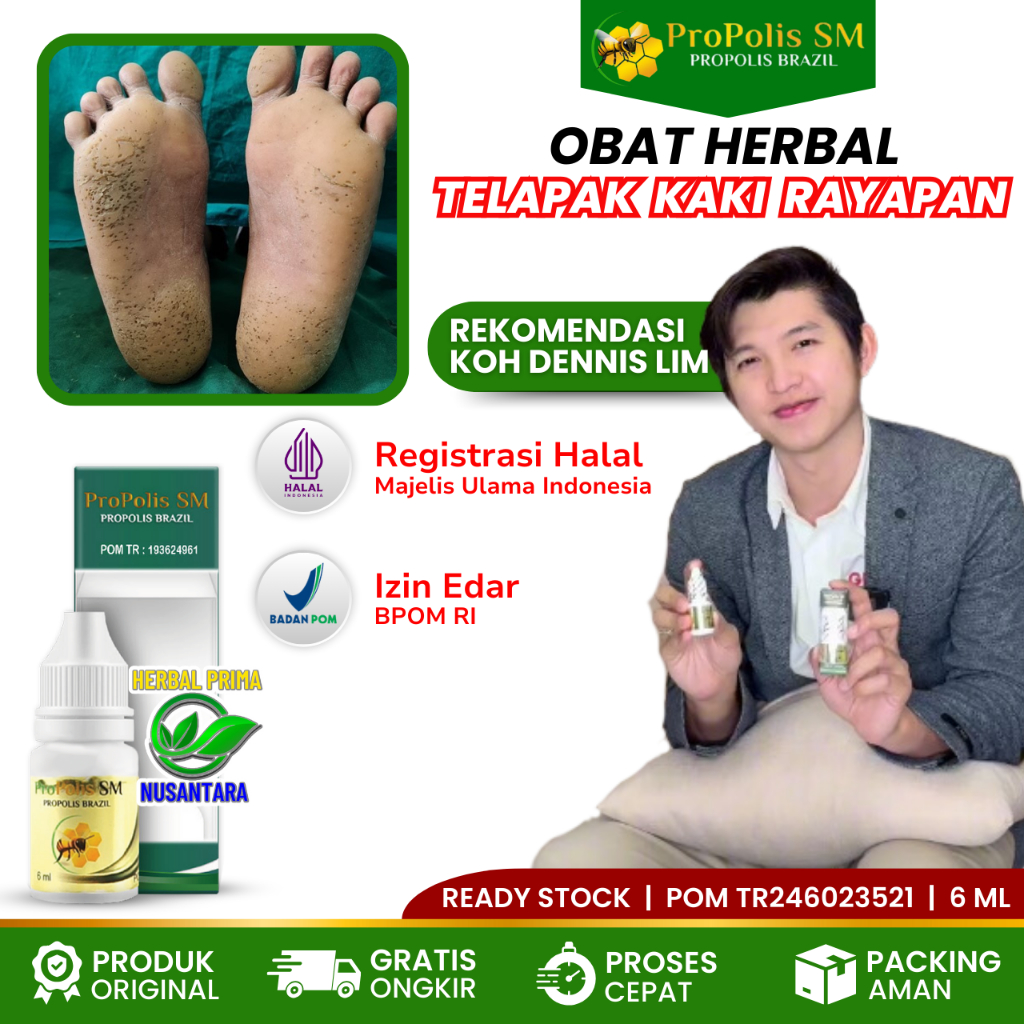 Jual Obat Tetes Kaki Rayapan Pitted Keratolisis Telapak Kaki Bolong ...