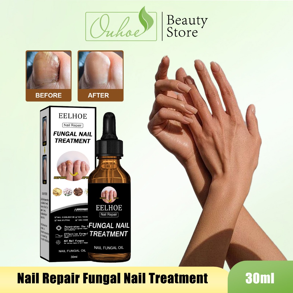 Jual EELHOE 【100%ORI/Beli 2 Gratis 1】 Nail Repair Fungal Nail Treatment ...