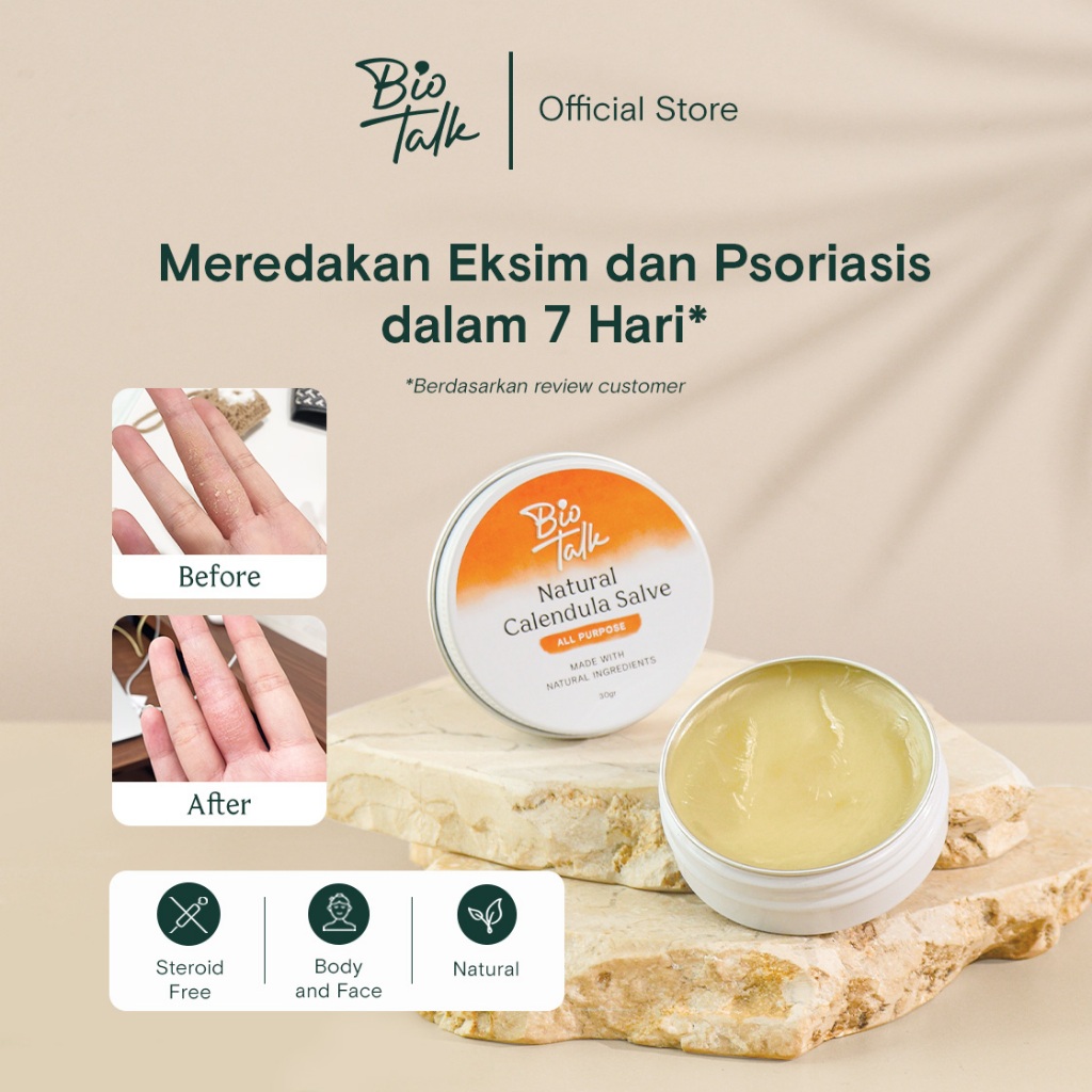Jual Biotalk Natural Calendula Salve | No Steroid | Meredakan Kulit ...