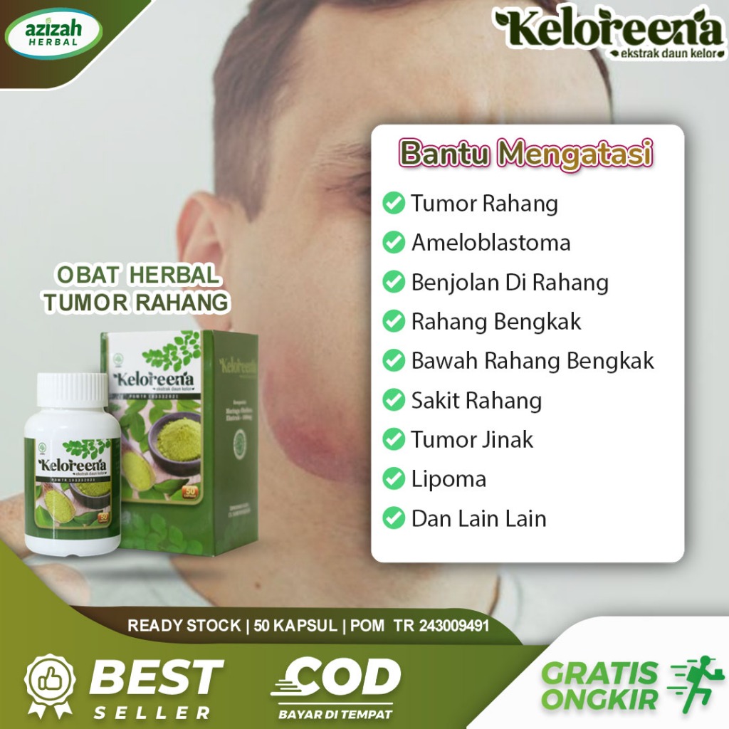 Jual Obat Tumor Rahang Ameloblastoma Benjolan Di Rahang Bawah ...