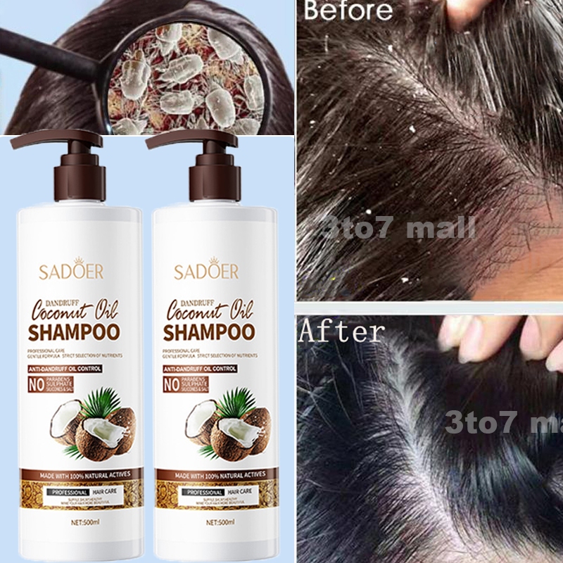 Jual shampoo anti dandruff shampoo shampoo psoriasis Anti Gatal perawatan rambut ketombe Garam ...