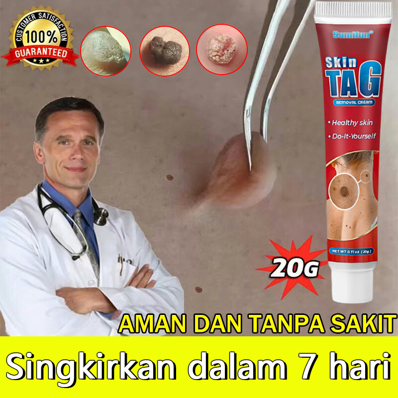 Jual Obat penghilang kutil Obat kutil kelamin Obat mata ikan Salep ...