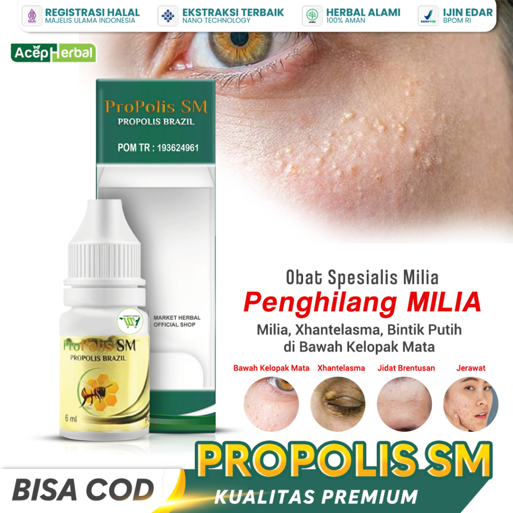Jual Obat Milia Di Bawah Kelopak Mata, Bintik Putih, Bercak Putih ...